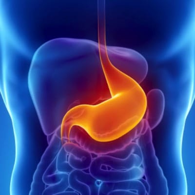 Gastro-Oesophageal reflux disease - Precision Upper GI